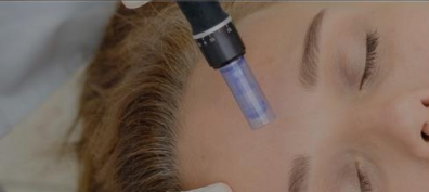 Let's talk about Microneedling – Orlando | Skin Care | Facials | Body ...